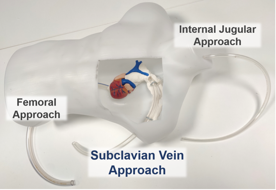 Cardiac surgery simulation: Advances in transvenous lead extraction | MMCTS