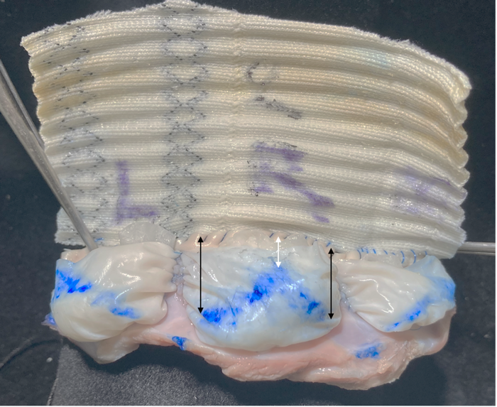 Striving for physiologic coaptation: An experimental and innovative ...
