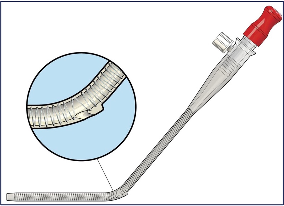 Femoral cannulation for cardiopulmonary bypass with a novel ...